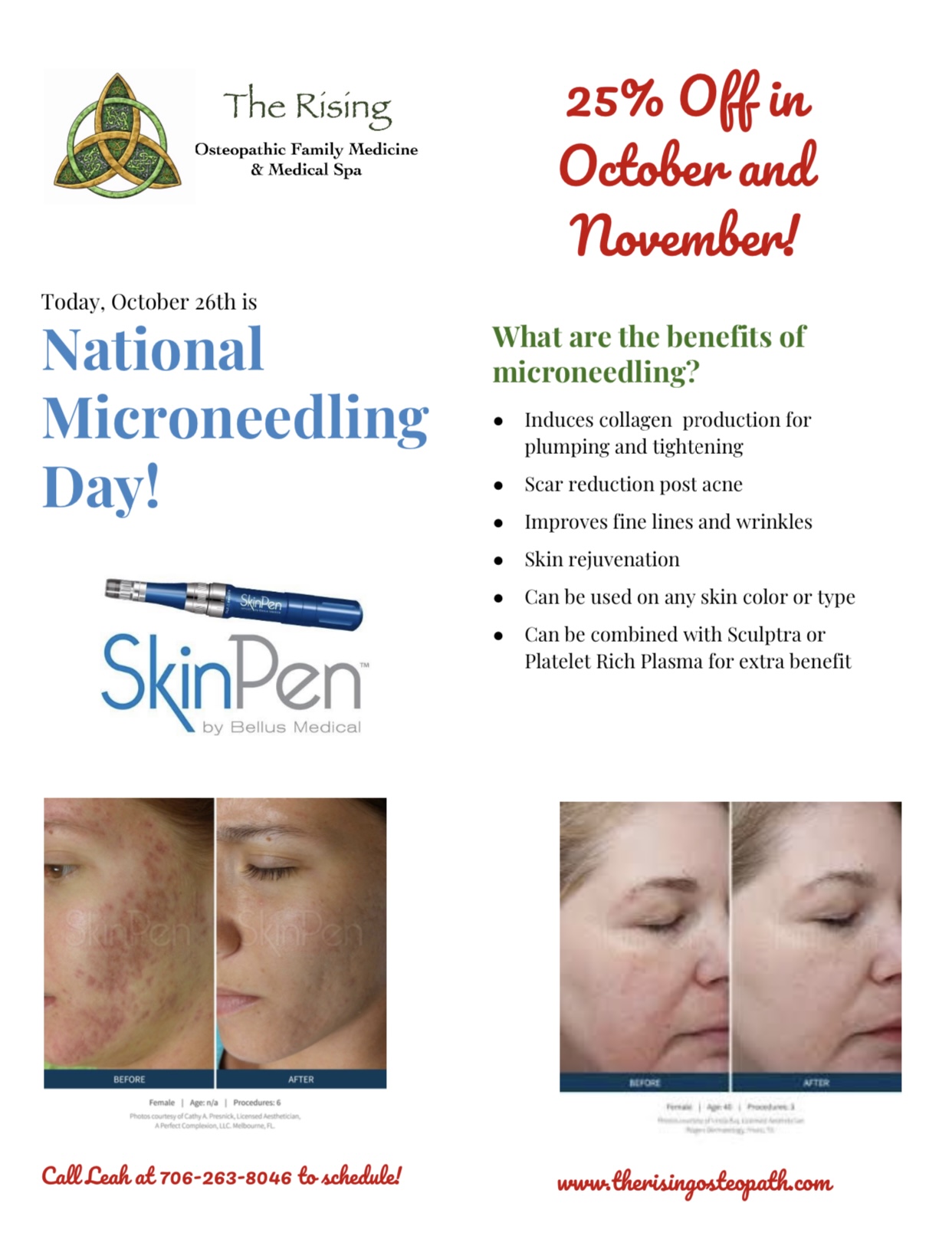 National Microneedling Day! – The Rising Osteopathic Family Medicine ...